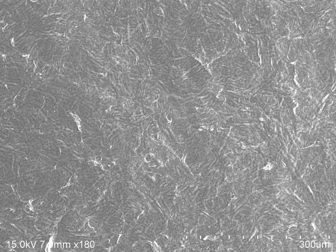 Corneal Lenticule Analysis through the Lens: Integrating Scanning ...